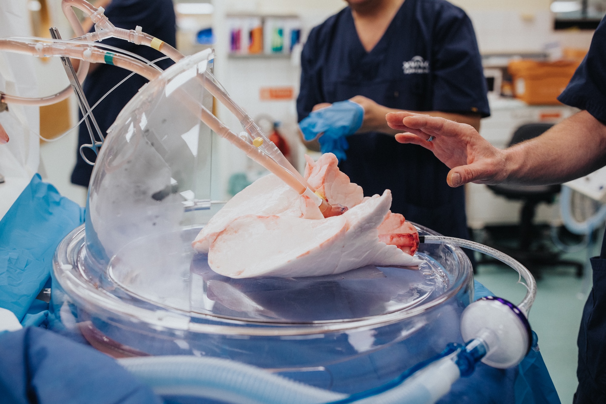 Rejected Lungs Revived in Indy: A U.S. First Saves Local Man